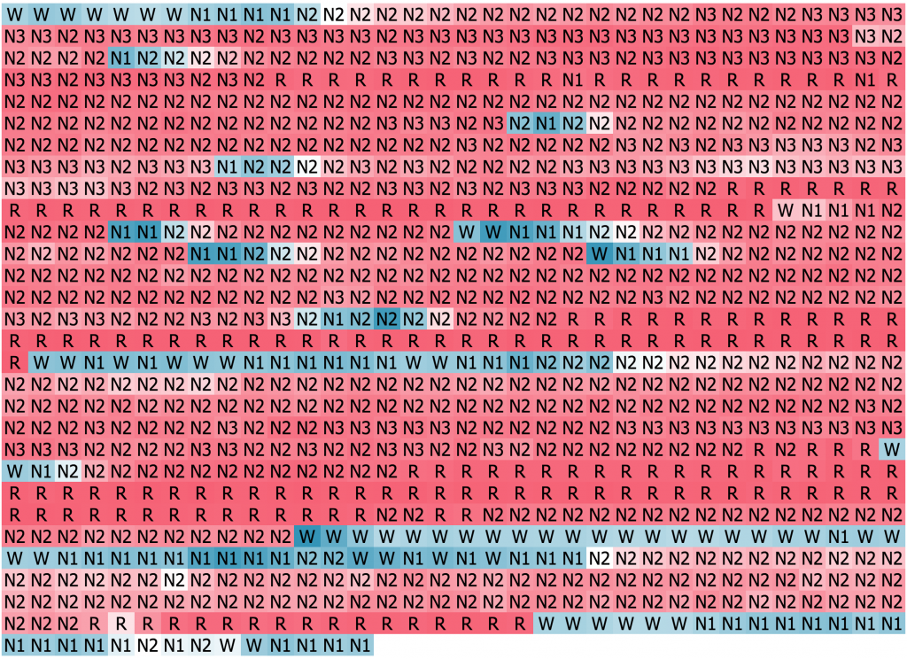 DeepSleepNet: An Answer for Sleep Quality through ...